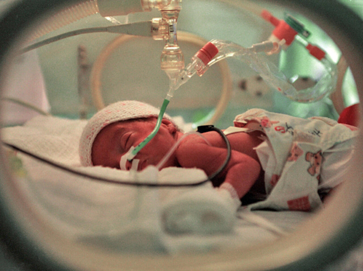 Retinopatía del Prematuro (ROP): Lo que los Padres Necesitan Saber – Le ...